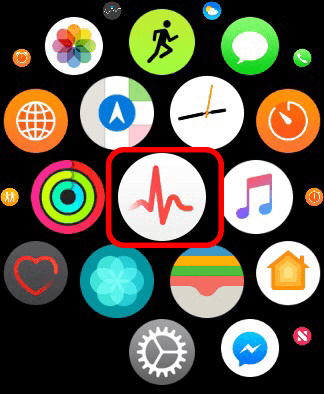 How to Set Up & Use the ECG Feature on Your Apple Watch
