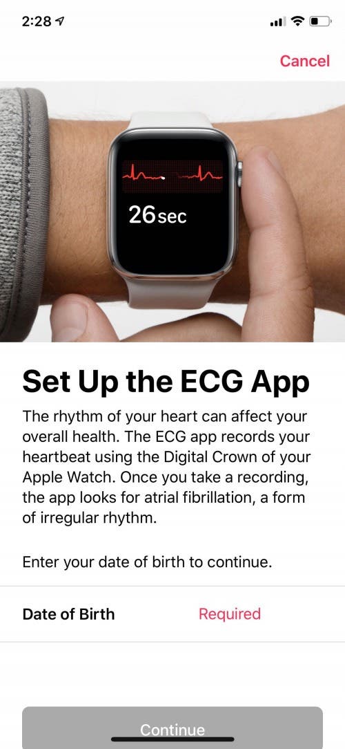 How to Set Up & Use the ECG Feature on Your Apple Watch